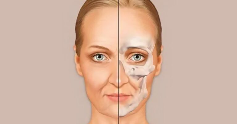 Bigode chinês: causas e tratamentos – Dra. Mariana Weber